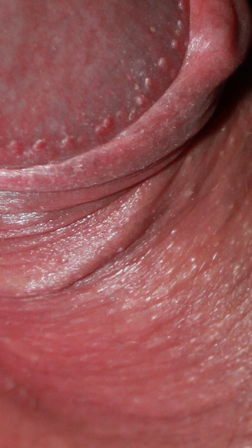 Close Up Dick 67 Pics Xhamster