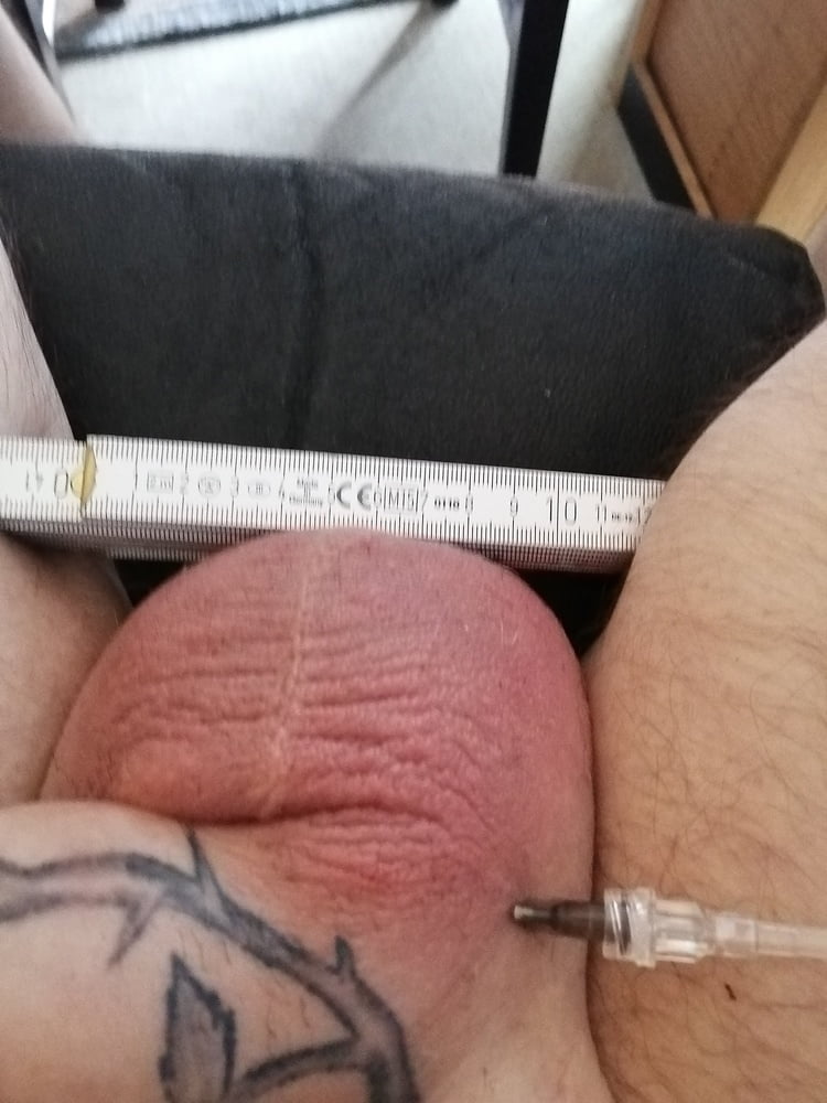 Saline Infusion Scrotum And Titti 3 L 72 Pics Xhamster 6312