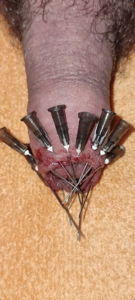 CBT Needles - 19 Pics | xHamster